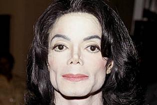 Michael Jackson está com câncer de pele, diz jornal